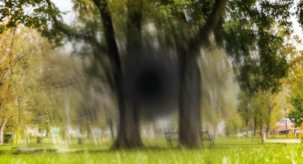 Macular Degeneration Retina Consultants Of Michigan